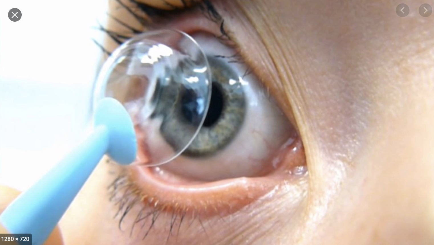 Lentilles - Cabinet d'Ophtalmo Pédiatrie